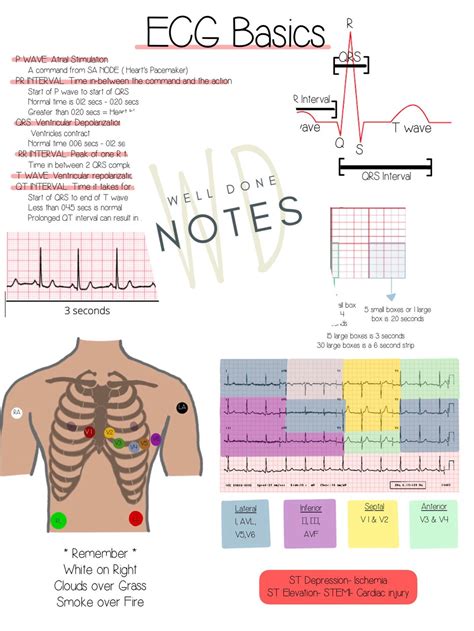 Ekg Basics Study Guide Etsy