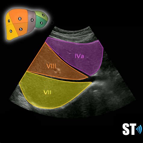 Couinauds Liver Segments Sonographic Tendencies
