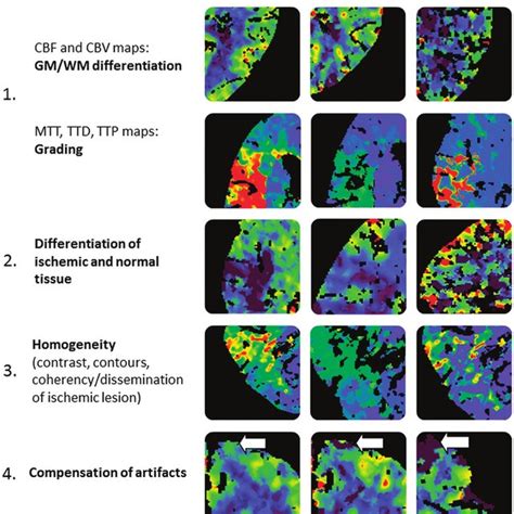 Ctp Scoring System In Relationship To Aspects M1 M2 M3 Insular Download Scientific Diagram