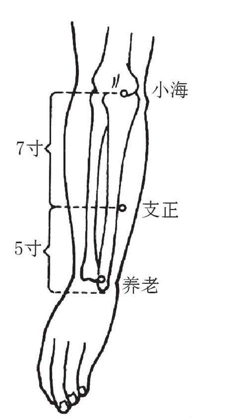 小海 穴位埋线疗法