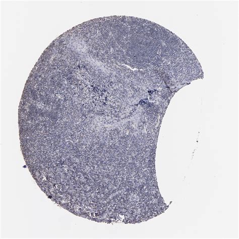 Tissue Expression Of Sox10 Staining In Tonsil The Human Protein Atlas