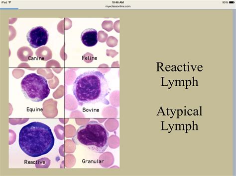 Reactive Lymph