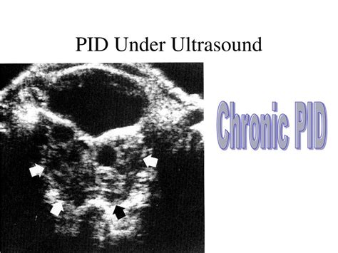 Ppt The Reproductive System Powerpoint Presentation Free Download
