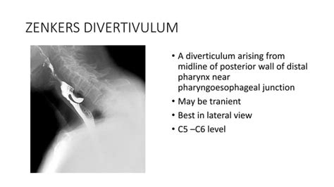 Upper Gi Fluro Exampptx