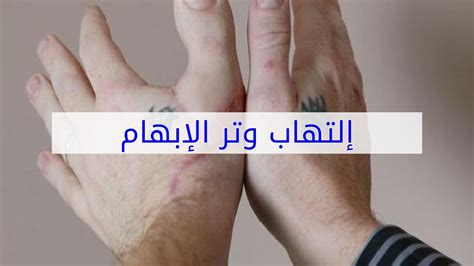 إلتهاب وتر الإبهام Youtube