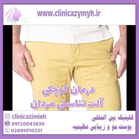 اندازه معمولی آلت تناسلی در حالت نعوظ