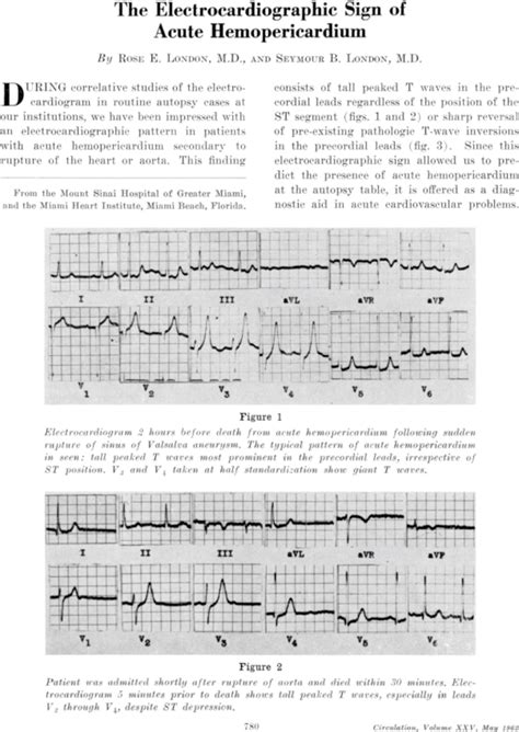 The Electrocardiographic Sign Of Acute Hemopericardium Circulation