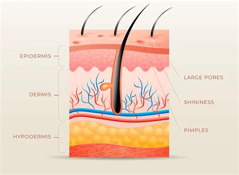 Nodular Acne A Comprehensive Guide Kins Clinic