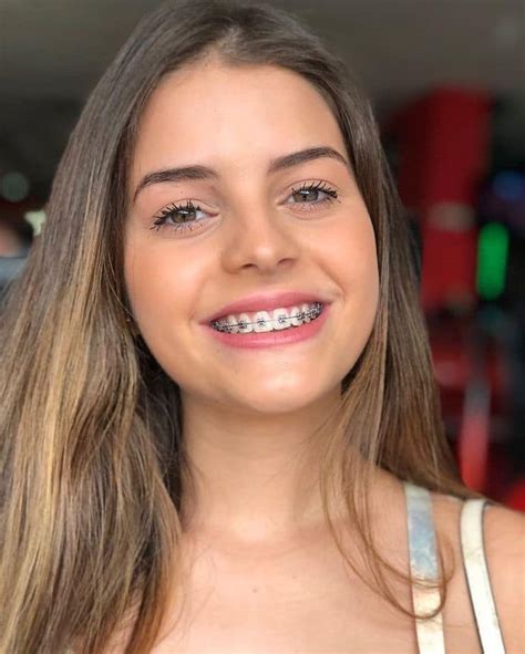 Ventas Tecate ️‼️promociÓn‼️ Niños Y Adultos Para Colocación De Brackets El Mismo Día💥🤩