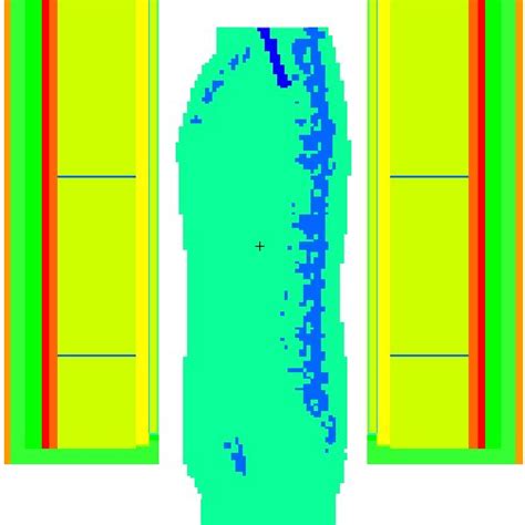 Sagittal Section Of Mcnp Model Of Rando Phantom And Philips Skylight