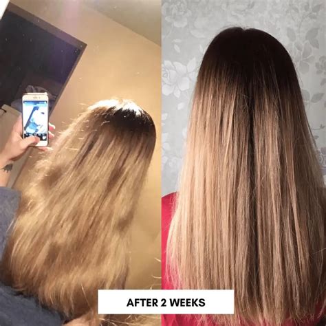 Moerie Hair Growth Set® Official Site Special 50 Off