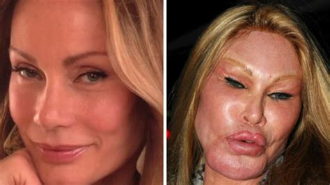 9 People Who Took Plastic Surgery Way Too Far Doovi