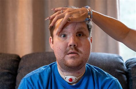 Derek Pfaff Receives Face Transplant