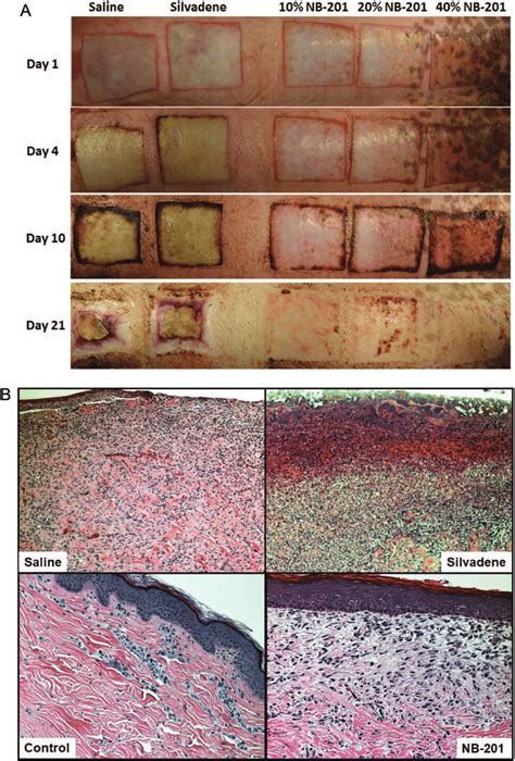 Visual Burn Wound Healing A Burn Wound Sites Were Created By