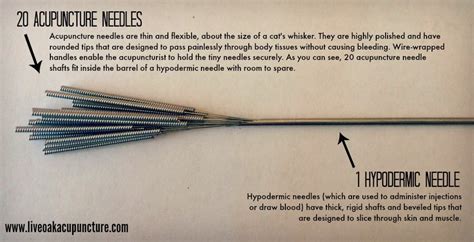 Acupuncture Faq Live Oak Acupuncture