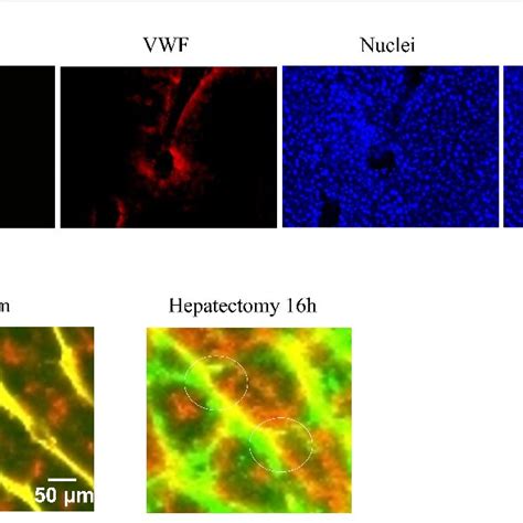 Monocyte Endothelial Cell Interactions And Vascular Sprouting Occurring