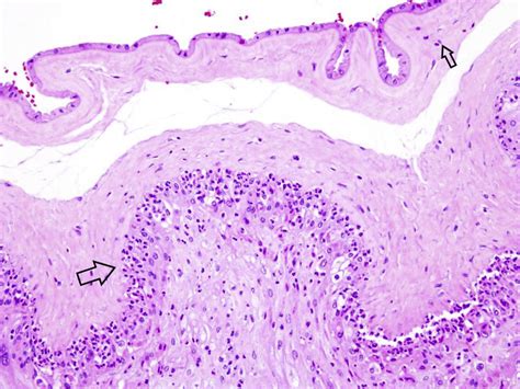 Placental Pathology Diagnostic Histopathology