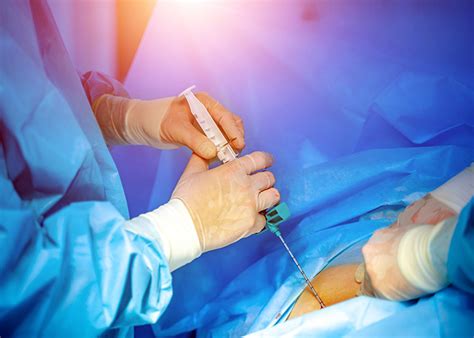 Bone Marrow Transplants With The Va Va Disability Group