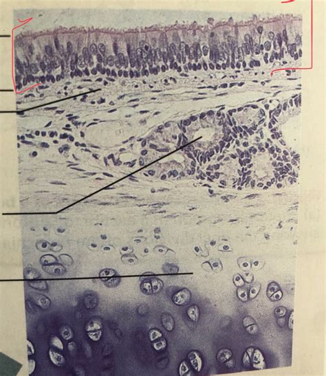Trachea Flashcards Memorang