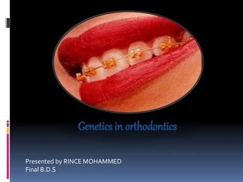 Tonsils And Adenoids And Their Effect On Growth Ppt
