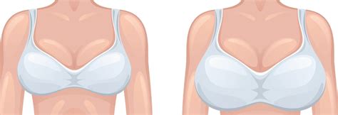 Does Breast Growth Ever Stop Brastop Uk