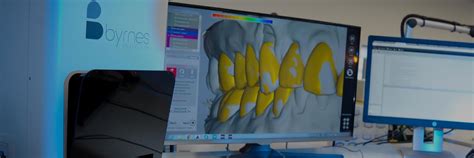 Digital Workflow Byrnes Dental Digital Dental Lab