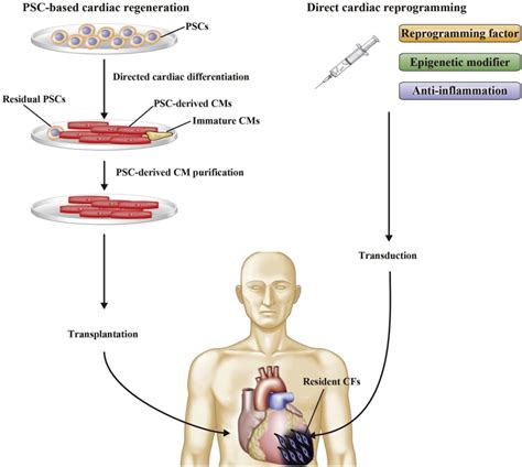 Cardiac Regeneration With Pluripotent Stem Cell Derived Cardiomyocytes