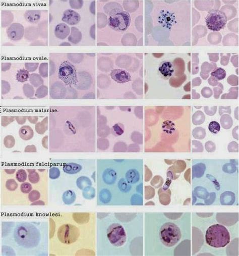 Medical Laboratory And Biomedical Science Malaria Training Materials