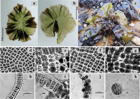 Morphological Features Of Py Aeodis A Morphology Of Thallus With Download Scientific