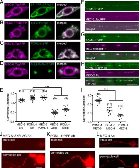 Caenorhabditis Elegans Paraoxonase Like Proteins Control The Functional