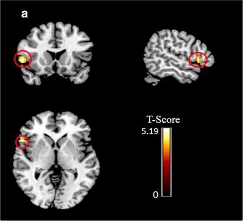 Group Differences In Functional Connectivity Within Frontoparietal