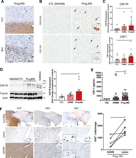 Excited To See Our Work On Csf1r Inhibition And Ms Has Been Published