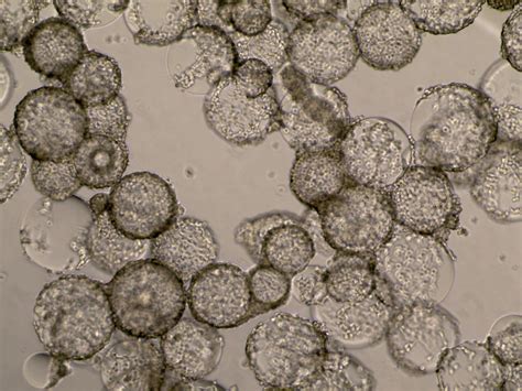 P2 Dissolvable Microcarriers Smart Biomaterials And µ Solutions Smart Mcs