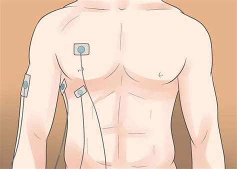 How To Measure Pr Interval