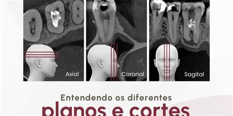 Planos E Cortes Irdo