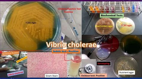 Vibrio Cholera Pathogenesis K R Pptx