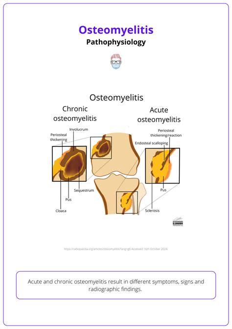 Osteomyelitis Clinical Features Investigations Management