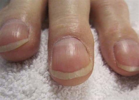 Was Sind Uhrglasnägel Und Wie Kann Ich Diese Behandeln Nageldesign