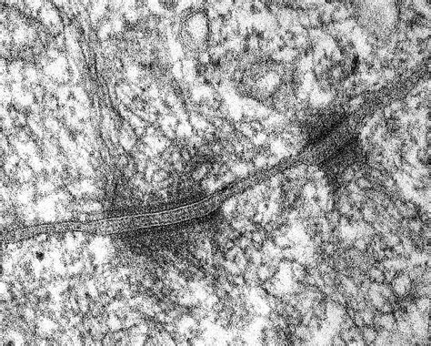 Desmosomes 1 Photograph By Science Photo Library Pixels