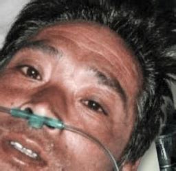 Who Was Hisashi Ouchi Tokaimura Nuclear Accident Worker Pop Creep