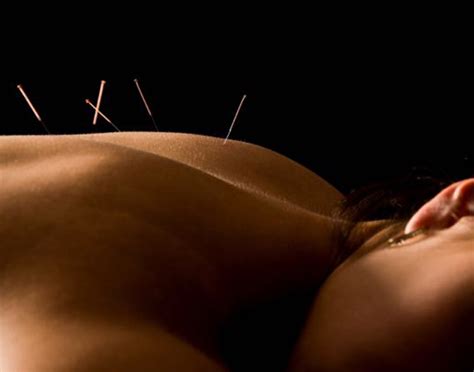 Overactive Bladder Alban Acupuncture