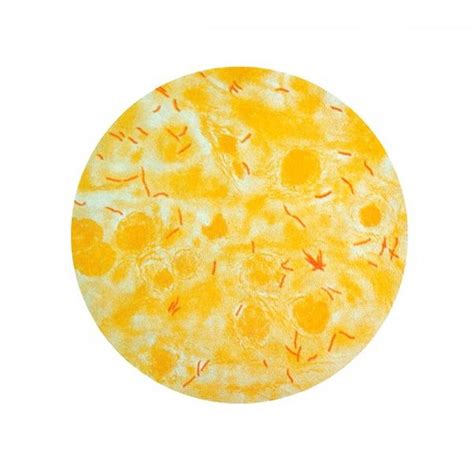 Imageacid Fast Stain Mycobacterium Tuberculosis Msd Manual