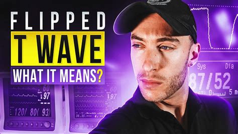 Peaked T Waves Decoding Your Ekg And What It Means For Your Heart