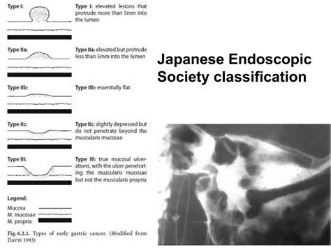 Fluoroscopic Imaging Anatomy And Pathology Of Stomach And Duodenum