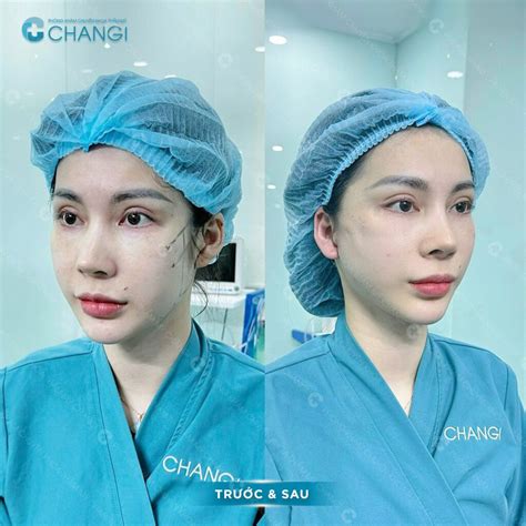 Địa Chỉ Căng Da Mini Plus Uy Tín Tại Thành Phố Hồ Chí Minh Phòng Khám