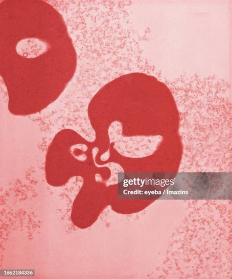 Bone Marrow Microscope Photos And Premium High Res Pictures Getty Images