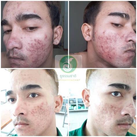 ลองนี่สิ The Megic Soap Organic Skin Herb