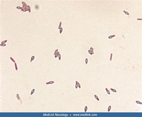 Endospore Bacteria Mold Spores Endospores And Exosporeswhat Are