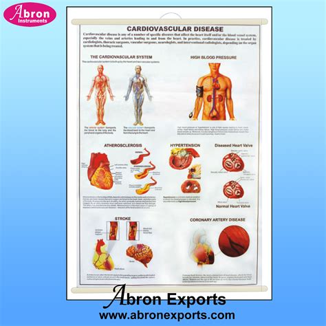 Human Diseases Chart