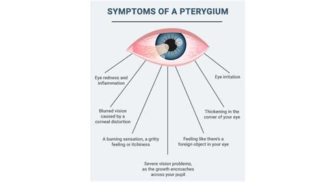 Pterygium Surgery Removal And Restoring Clear Vision
